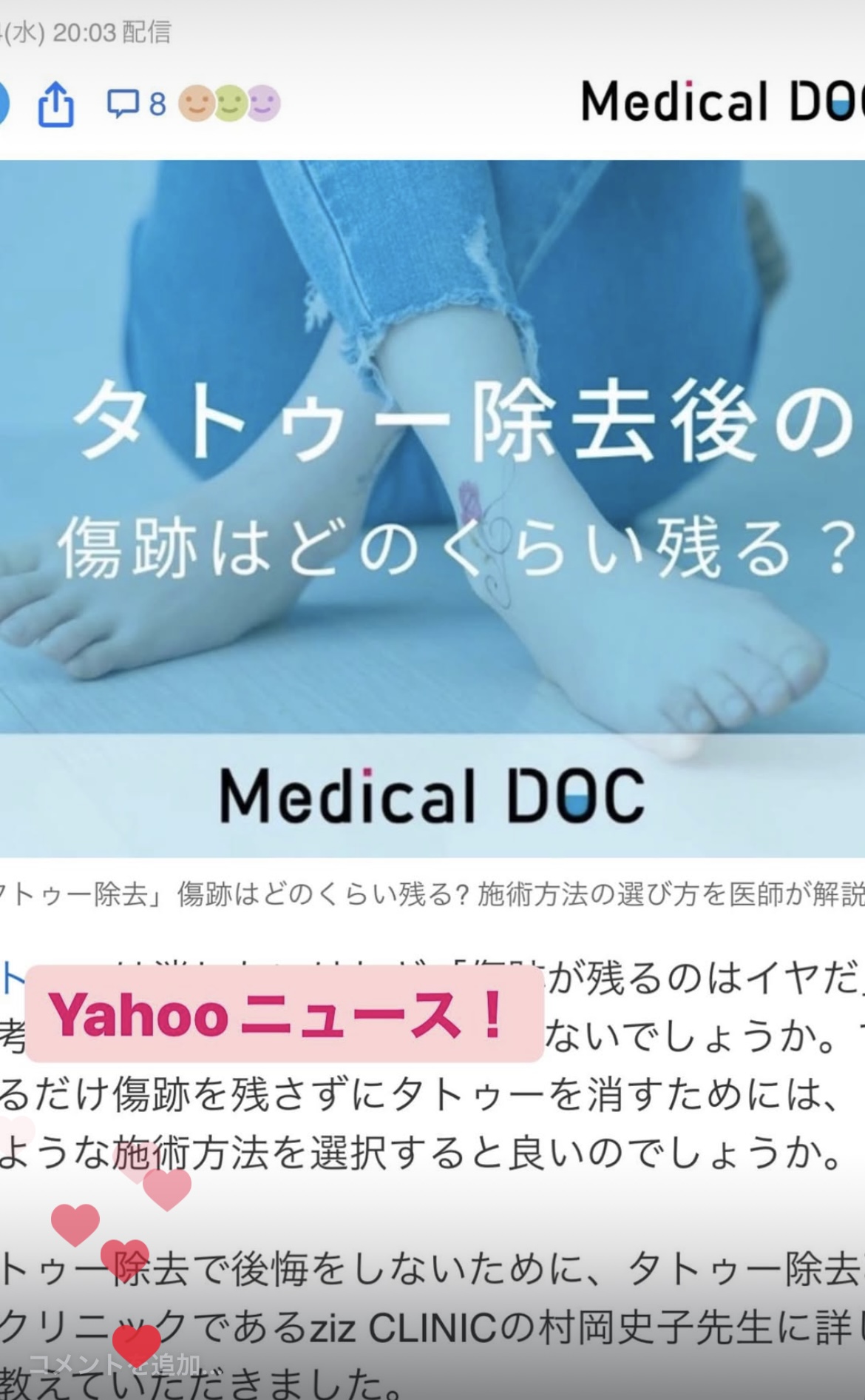 【Yahoo!ニュース】また掲載されました！ - タトゥー除去専門の美容クリニック ziz CLINIC ―ジズクリニック―